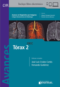 Tórax 2, avances en diagnóstico por imágenes – Grupo CT Scanner