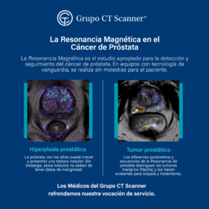 La resonancia magnética en el cáncer de próstata – Grupo CT Scanner