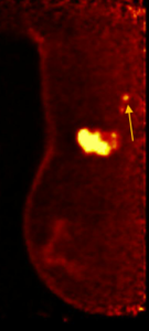 Mastografía por Emisión de Positrones (PEM) – Grupo CT Scanner