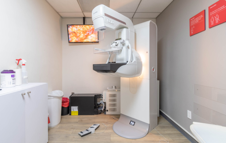 Mastografía – Grupo CT Scanner