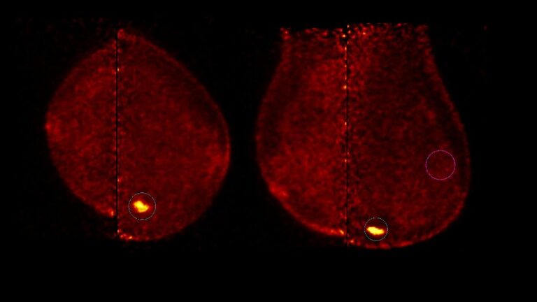 PEM – Grupo CT Scanner