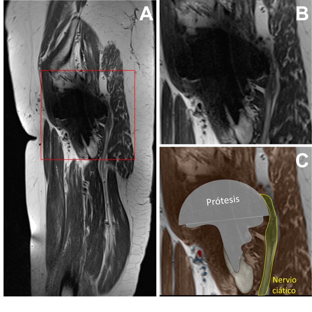 Unidades TC en Grupo CT Scanner – Grupo CT Scanner